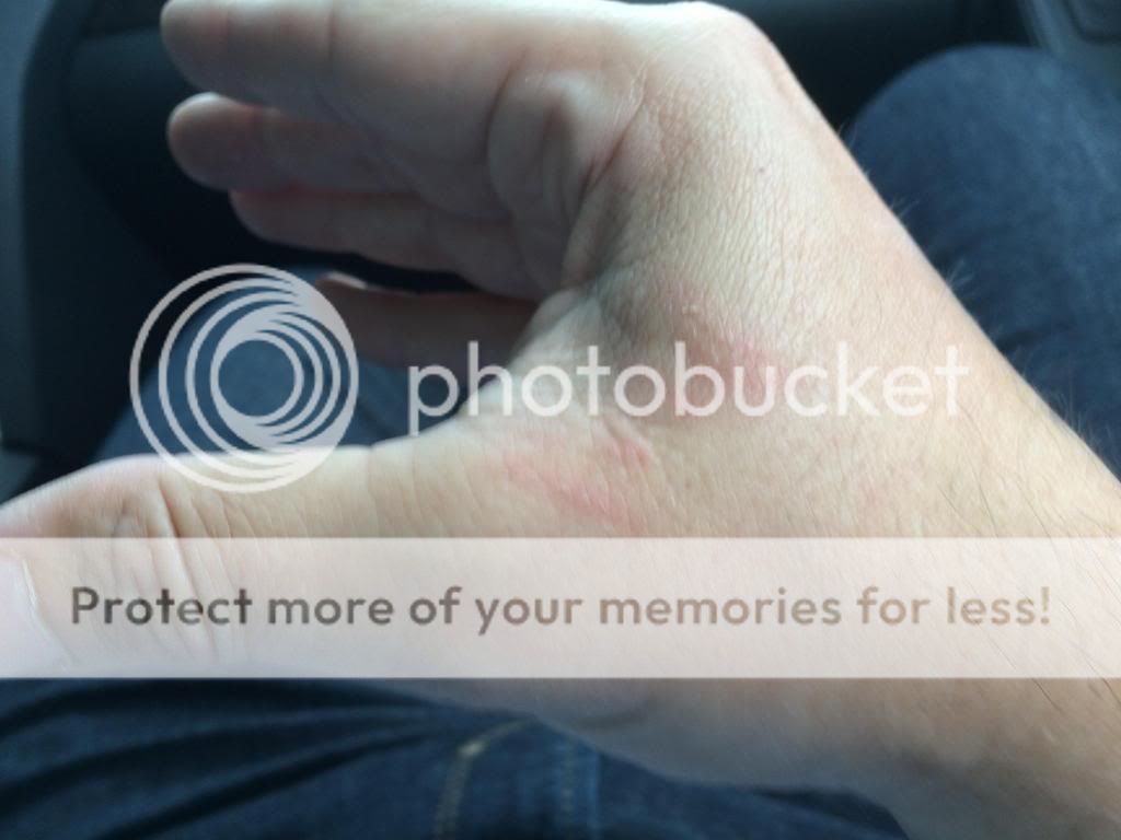 PPK slide bite...not as bad as expected > General Discussion > AR15.COM